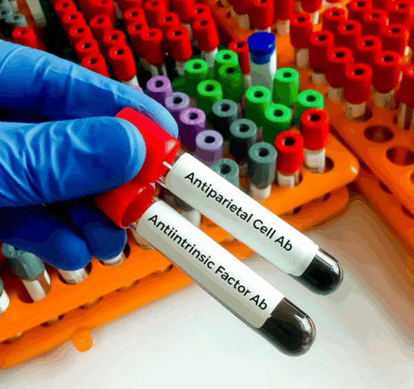 Understanding Autoimmune Disease: A Guide to Tests and Diagnosis - Cure ...